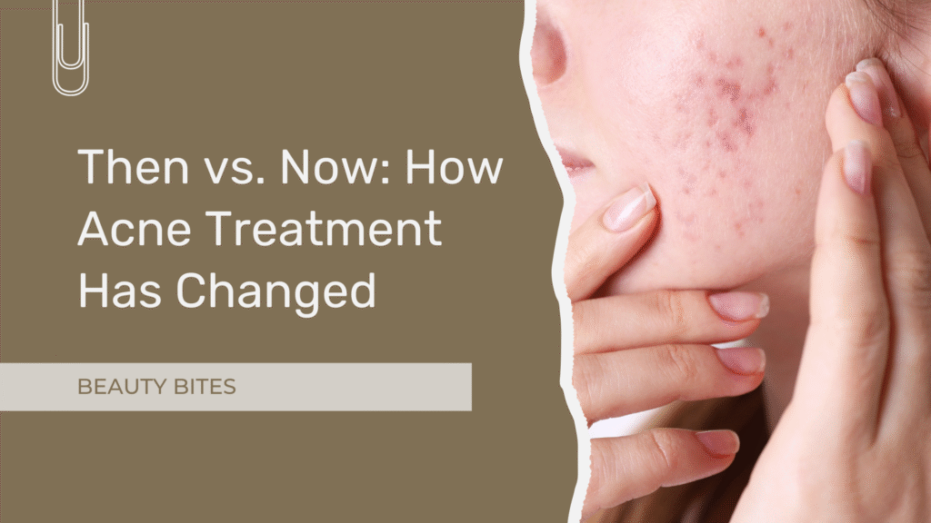 Then vs. Now: How Acne Treatment Has Changed